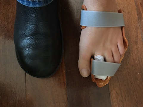 Case Study - Burst-Type Fracture Flex Physio